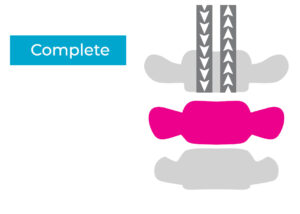 Understanding Spinal Cord Injury (SCI) | Spinal Cord Injury Ontario