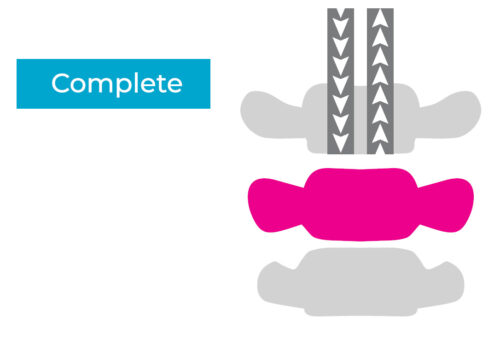 Understanding Spinal Cord Injury (SCI) | Spinal Cord Injury Ontario